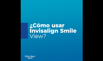 Tutorial Smile View - Telaio